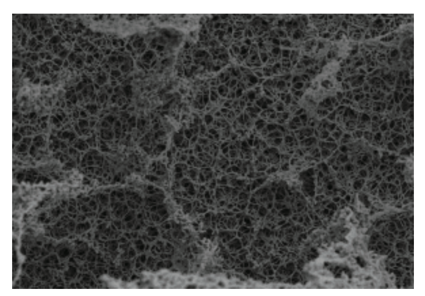 Virus Removal filter - Gripharma